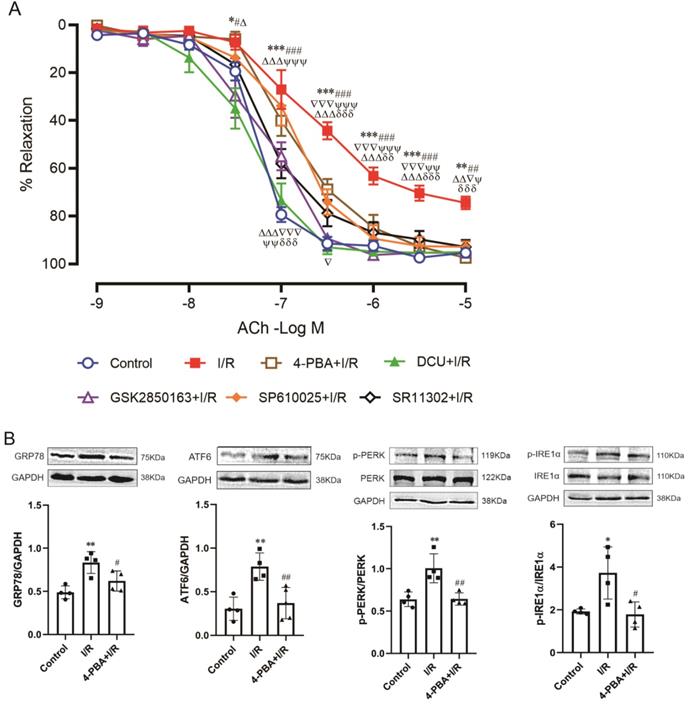 Targeting IRE1α-JNK-c-Jun/AP-1-sEH Signaling Pathway Improves ...