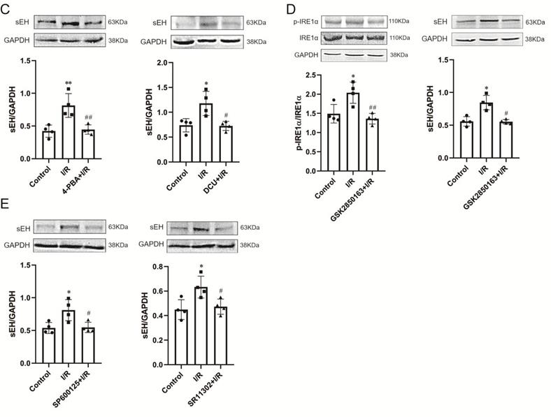 Targeting IRE1α-JNK-c-Jun/AP-1-sEH Signaling Pathway Improves ...