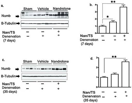 Denervation Atrophy of Skeletal Muscle is Not Influenced by Numb Levels ...