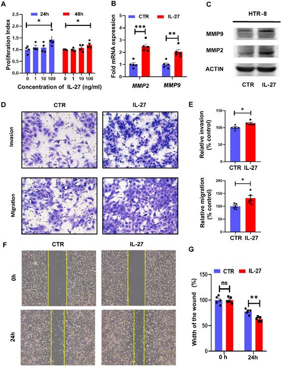 IL-27 deficiency inhibits proliferation and invasion of trophoblasts ...