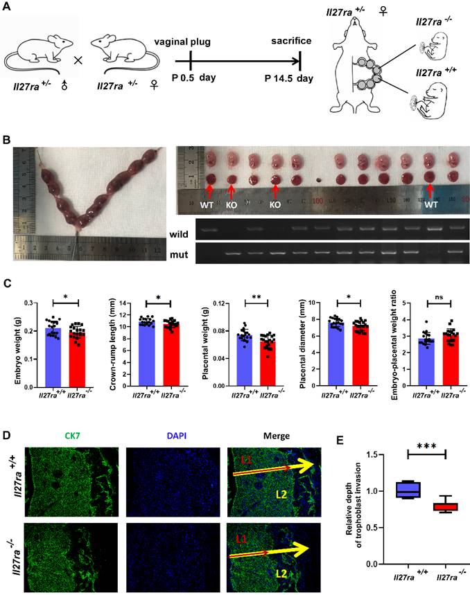 IL-27 deficiency inhibits proliferation and invasion of trophoblasts ...