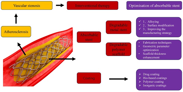 Research progress of absorbable stents
